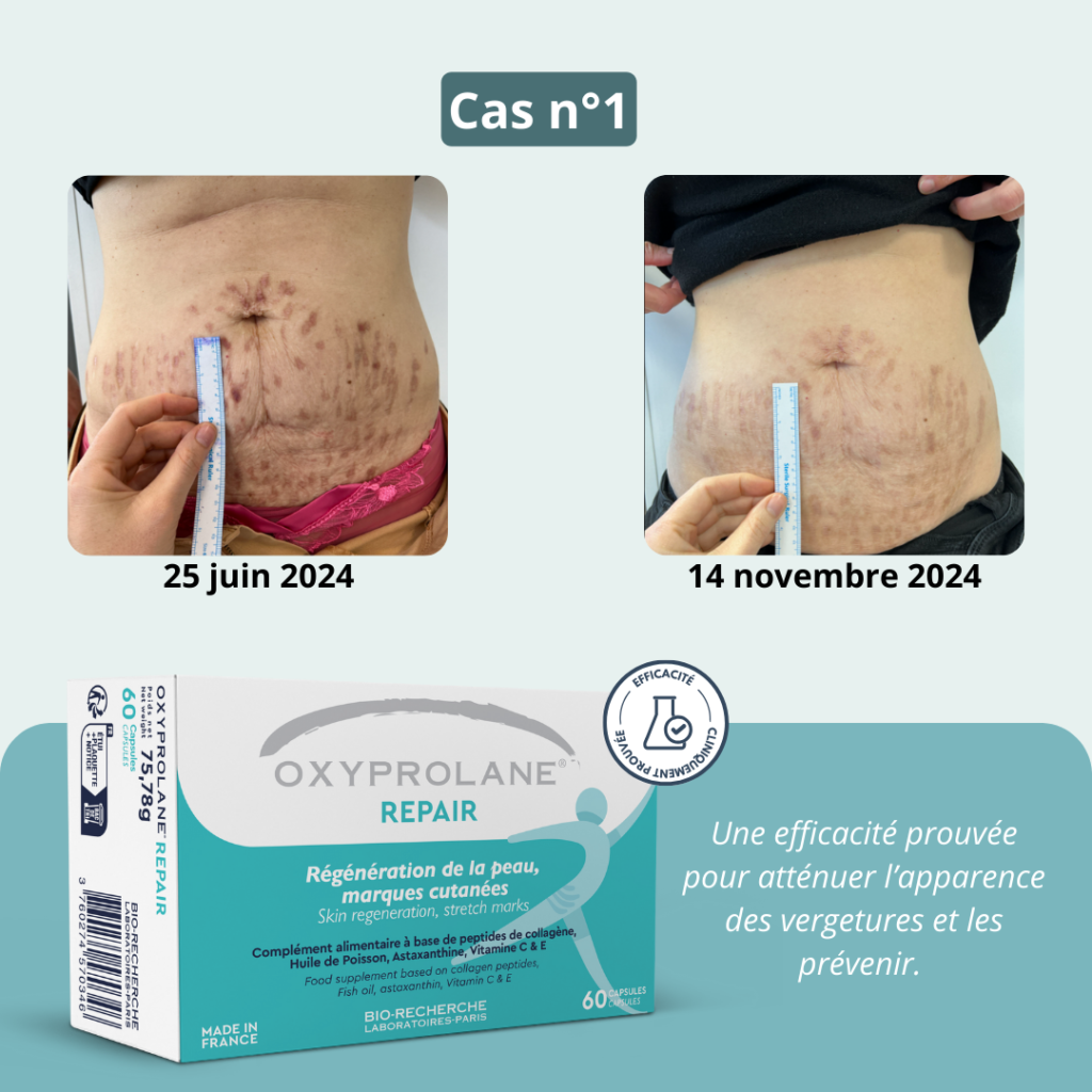 Oxyprolane Repair - Régénération de la peau, vergetures